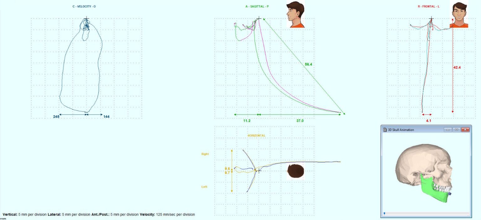 JT-3D - Jaw Tracker - BioRESEARCH Associates
